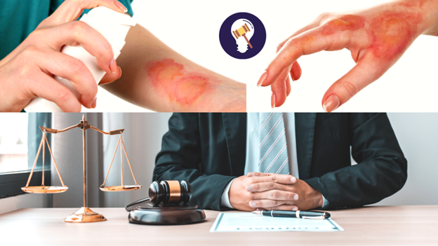 The Importance of Medical Documentation in Burn Injury Cases - The ...